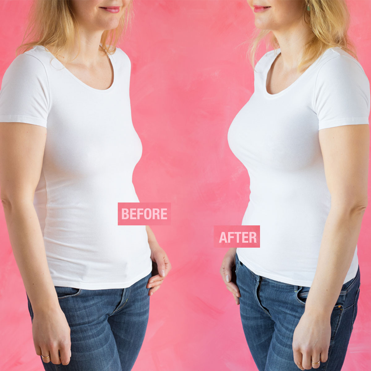 lifting des seins à Istanbul – avis et meilleurs prix 2023 - Traitement ...